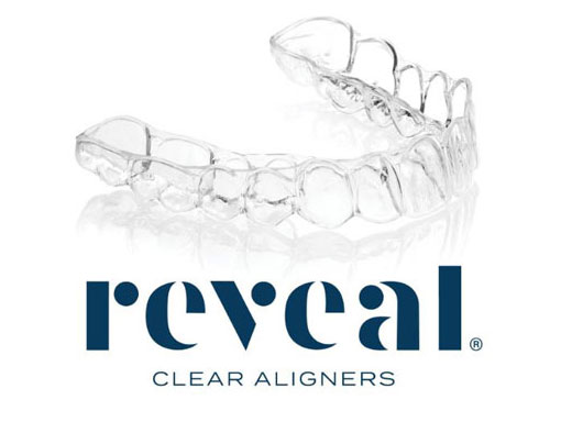 Reveal Aligners in Omaha | Dental Innovations